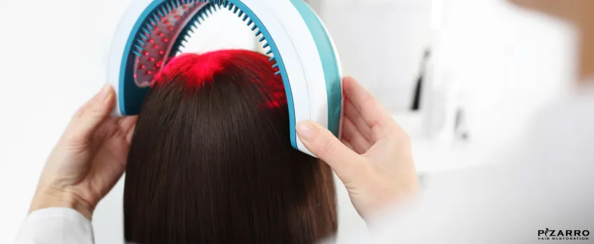 Why Laser Therapy Is a Sustainable Hair Loss Solution | Pizarro Hair ...