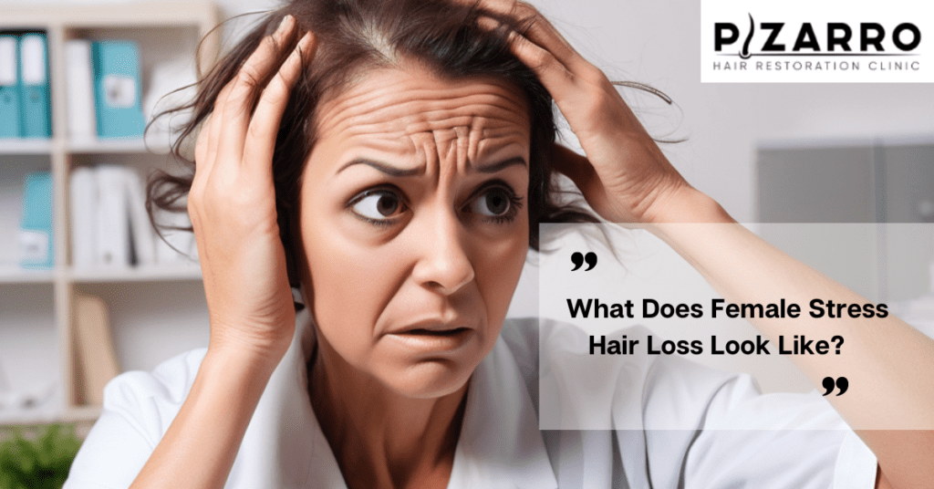 Where to Find the Cheapest Hair Transplant in USA | Pizarro Hair ...